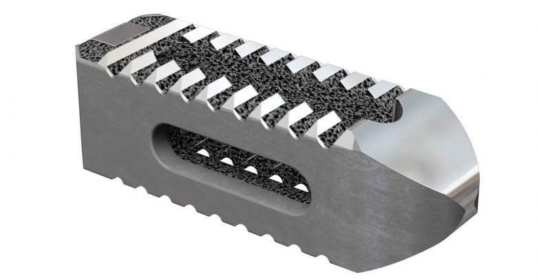 Stryker, J &J bet on medical tech uses of 3D printing – Adam Mayers